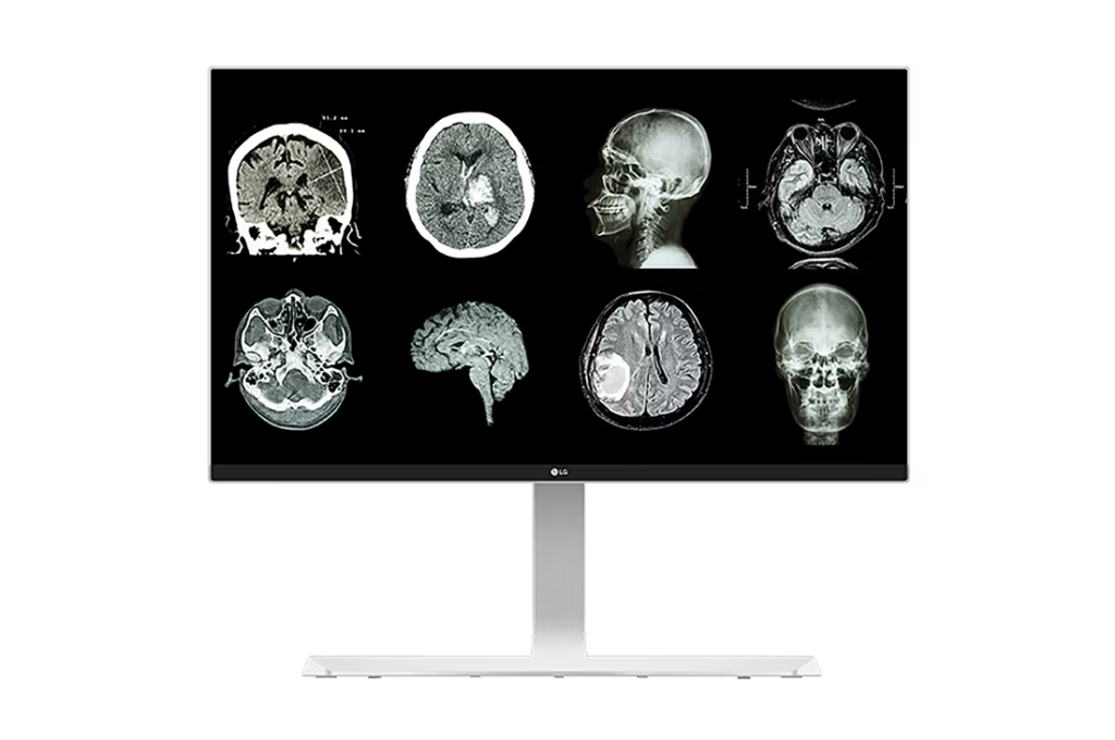 Medical Monitors: Hospital Monitors for Radiology & Surgical Displays