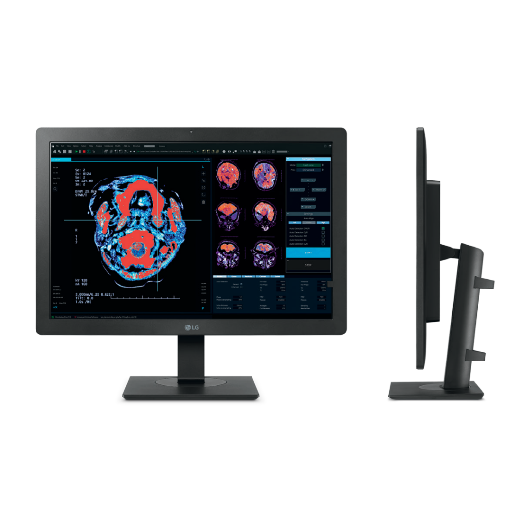 Medical Monitors: Hospital Monitors for Radiology & Surgical Displays