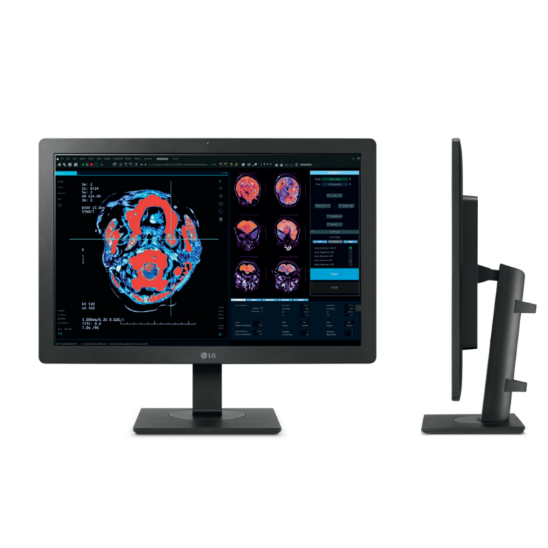 Medical Monitors: Hospital Monitors for Radiology & Surgical Displays
